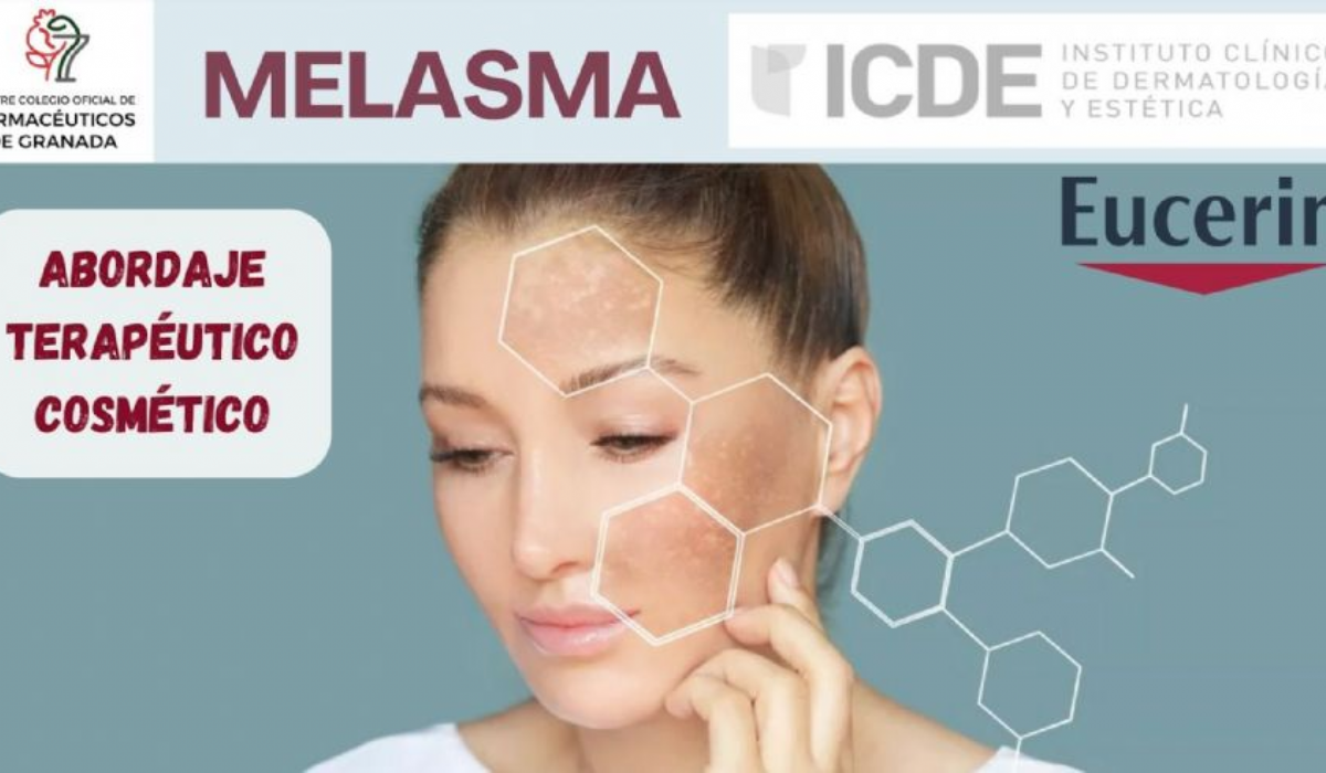Melasma, abordaje terapéutico cosmético